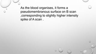 Ultrasound of eye - B scan | PPTX
