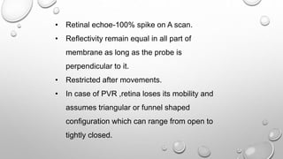 Ultrasound of eye - B scan | PPTX