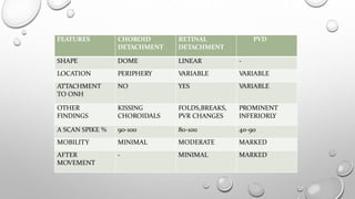 Ultrasound of eye - B scan | PPTX