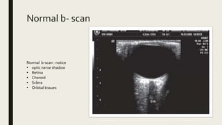 B scan clinical cases 1 | PPTX