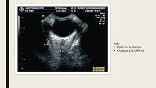 B scan clinical cases 1 | PPTX