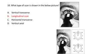 B scan MCQs for MLOPs.pptx