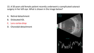 B scan MCQs for MLOPs.pptx