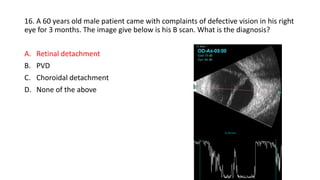 B scan MCQs for MLOPs.pptx