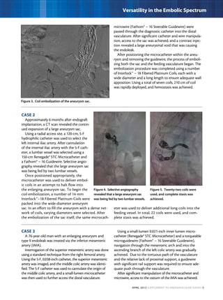 ENDOVASCULAR TODAY - BOSTON SCIENTIFIC | PDF
