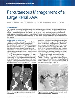ENDOVASCULAR TODAY | PDF
