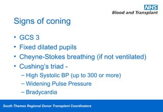 Brain Stem Death Testing | PPT