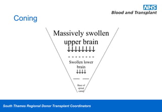 Brain Stem Death Testing | PPT