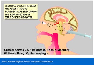 Brain Stem Death Testing | PPT