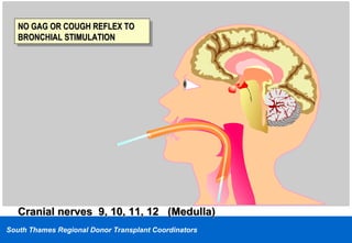 Brain Stem Death Testing | PPT