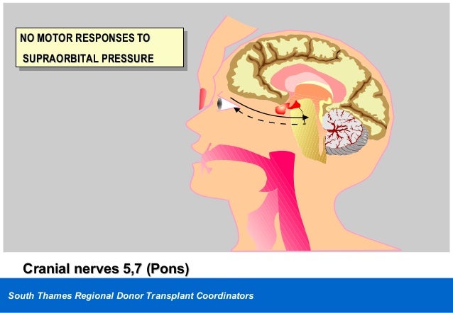 Brain Stem Death Testing brain-stem-death-testing