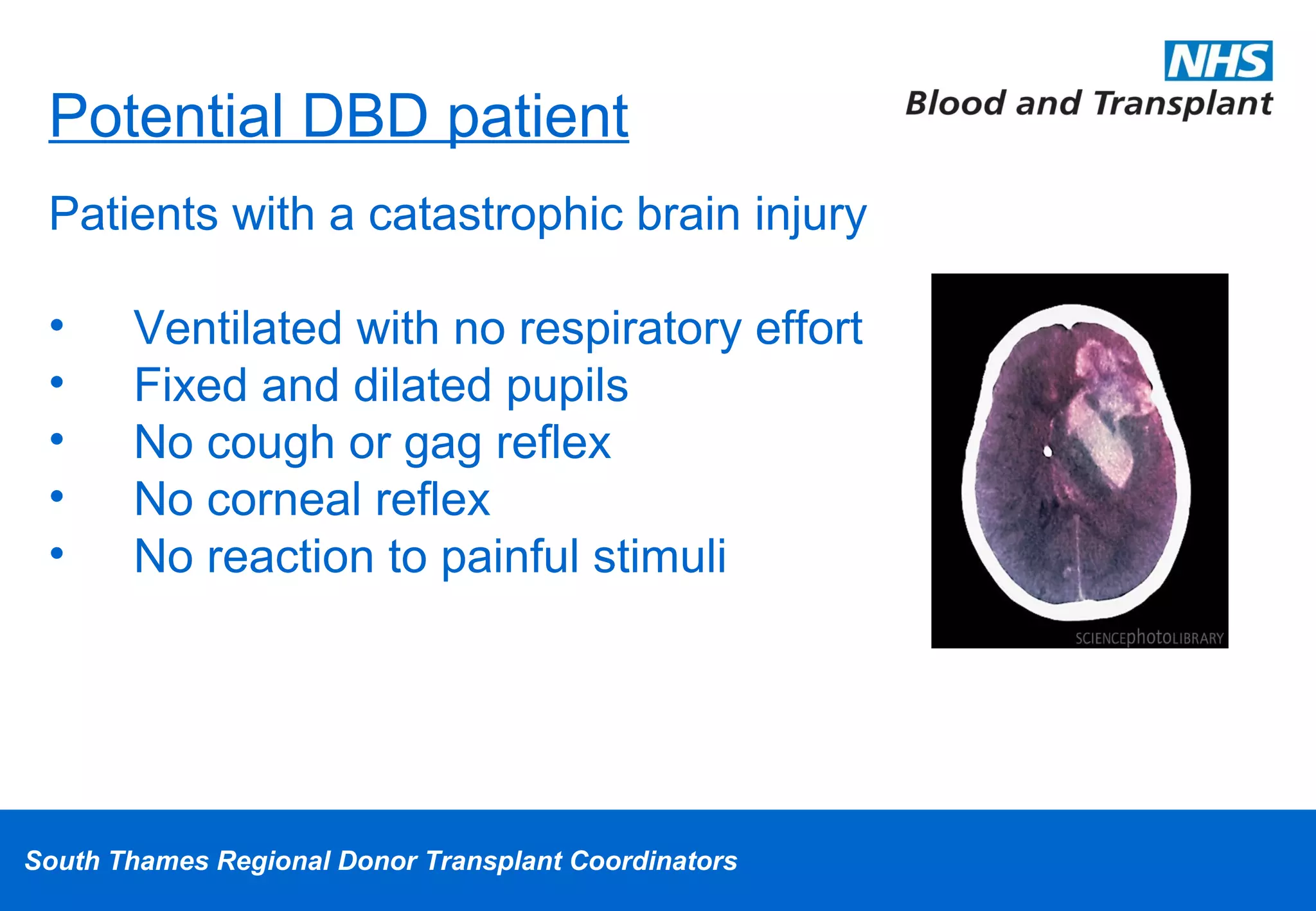 Brain Stem Death Testing and Organ Donation | PPT
