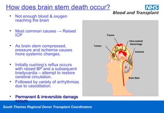 Brain Stem Death Testing and Organ Donation | PPT