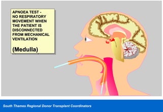 Brain Stem Death Testing and Organ Donation | PPT