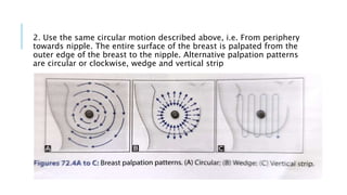 BSE PROCEDURE (GYNEC) (GNM-3) (VARSHA).pptx | Cancer | Diseases and ...