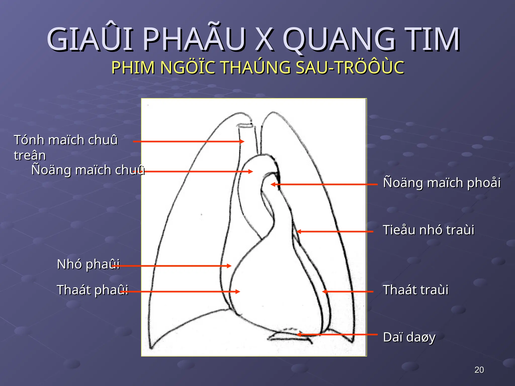 Bs Khoang - chan doan hinh anh tim mach | PPT
