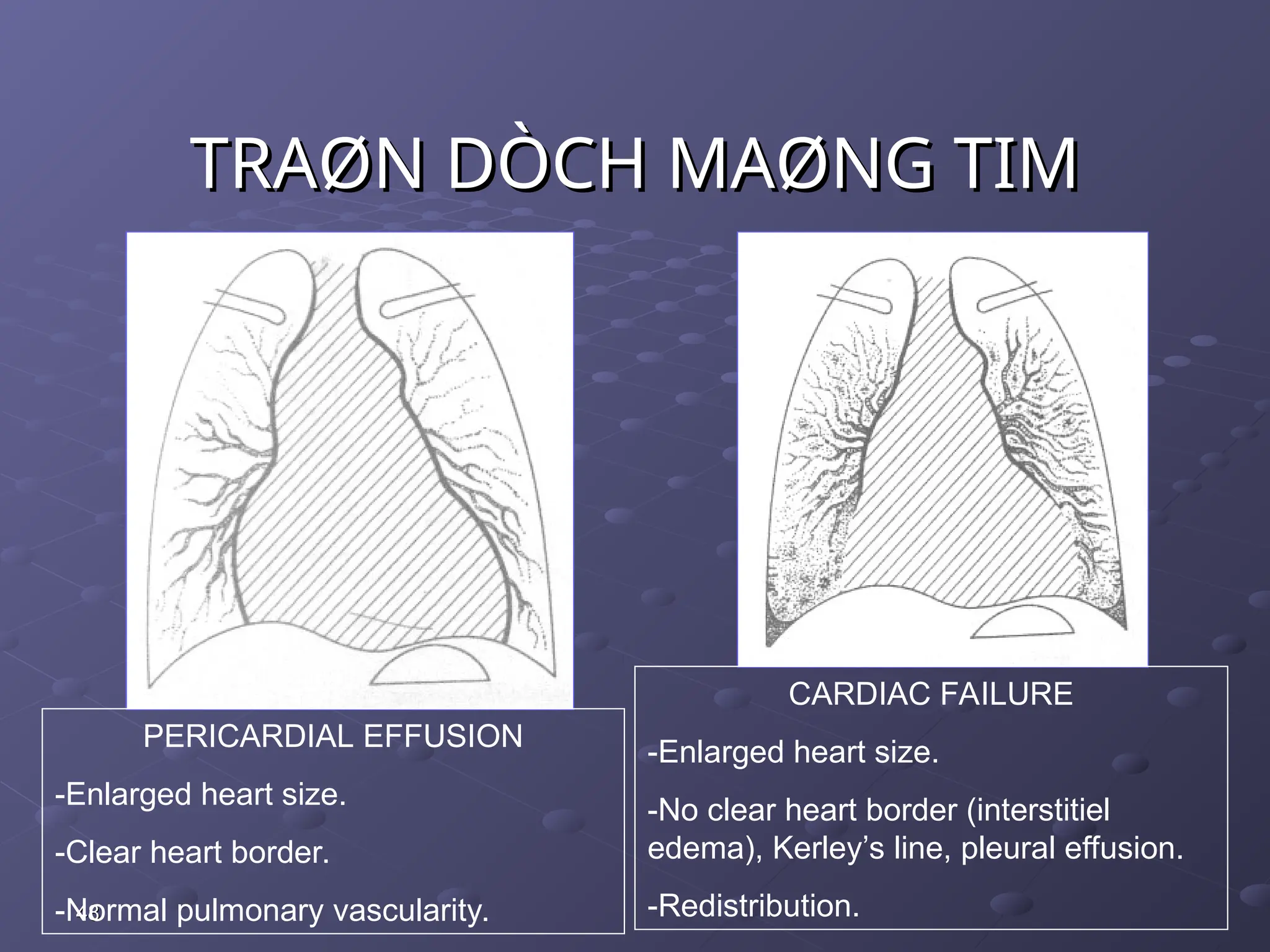 Bs Khoang - chan doan hinh anh tim mach | PPT