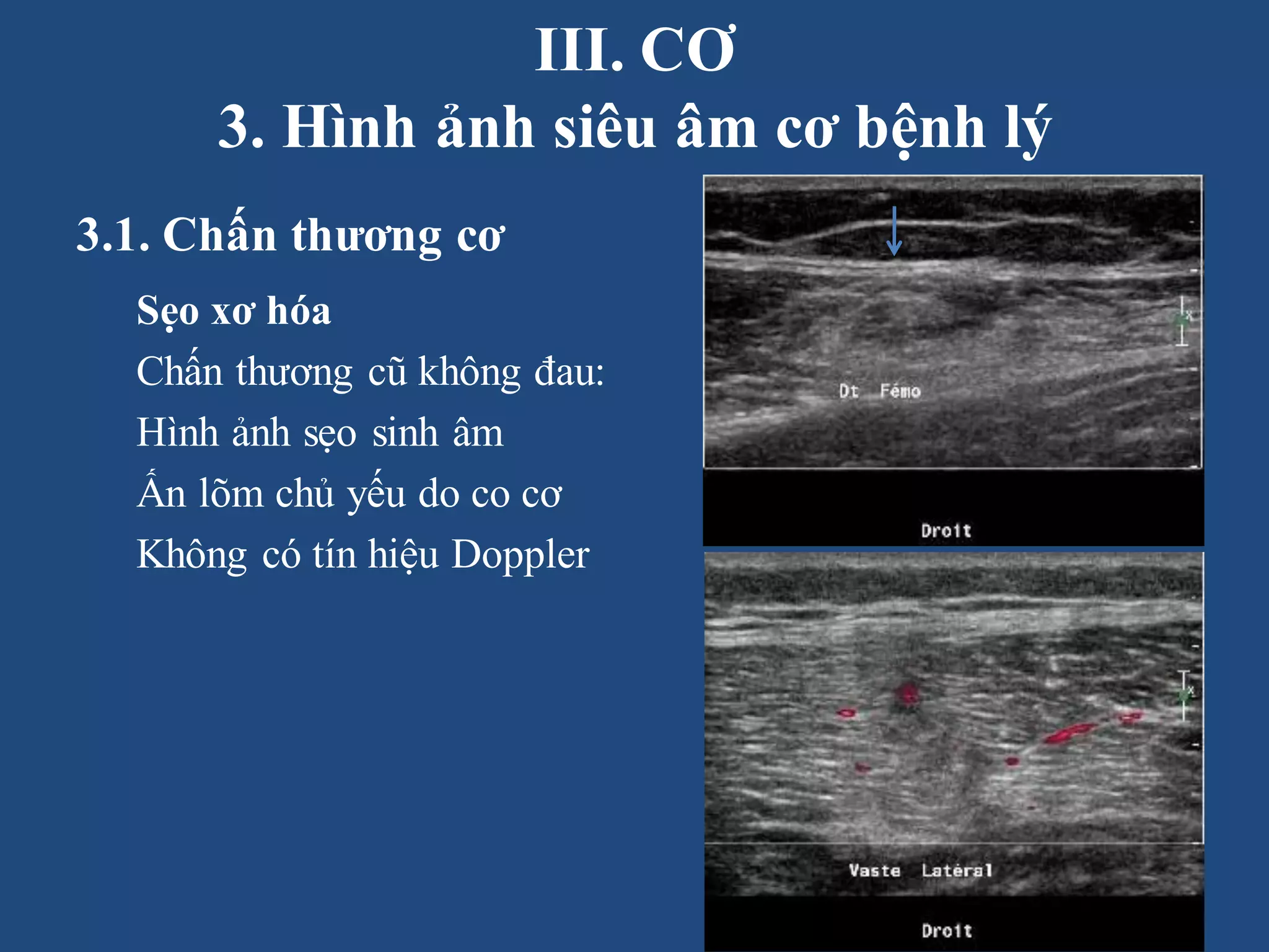Tổng quan siêu âm cơ xương khớp, Bs Liêm | PDF