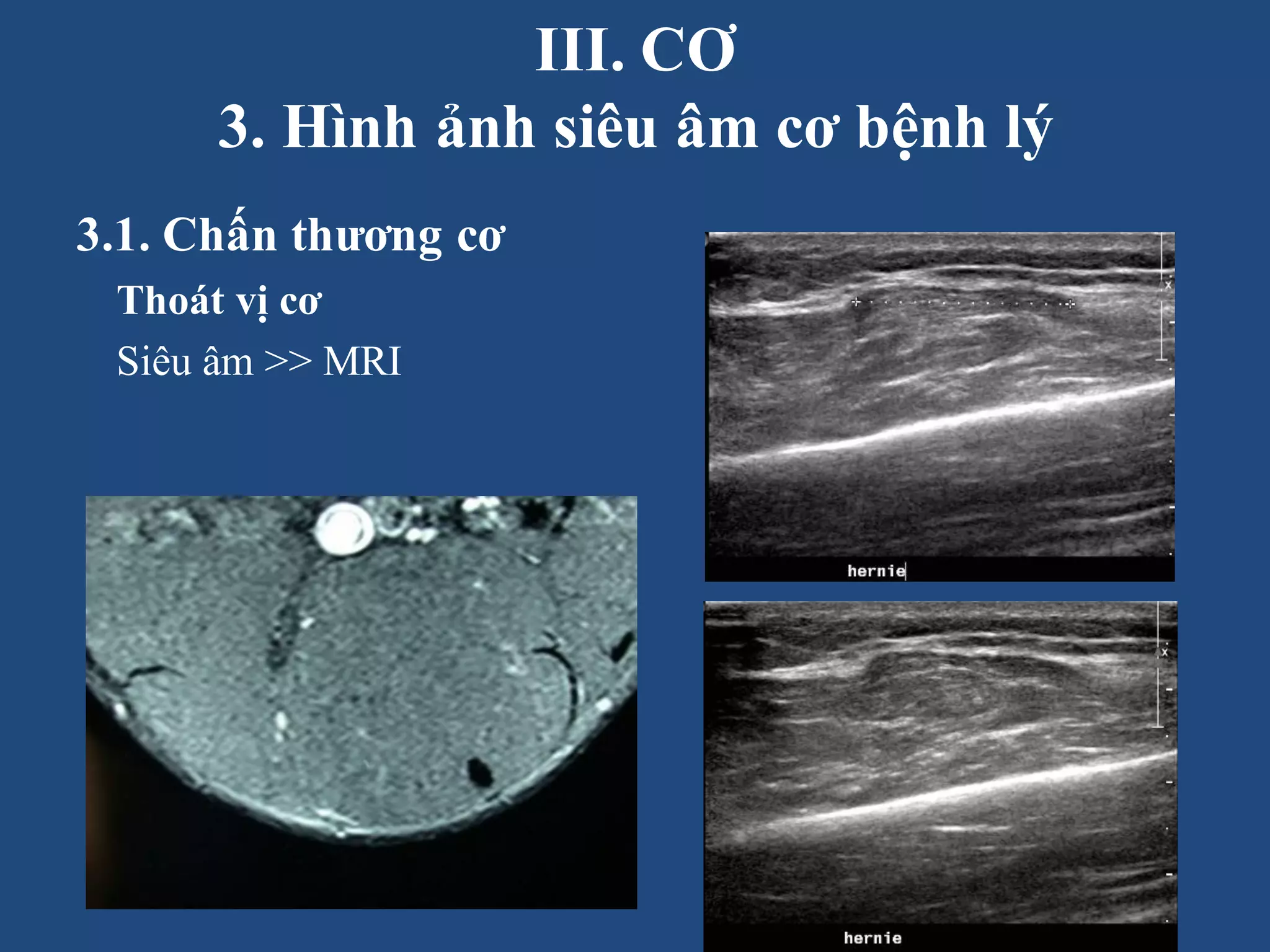 Tổng quan siêu âm cơ xương khớp, Bs Liêm | PDF