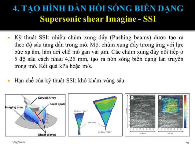 Tổng quan siêu âm đàn hồi và ứng dụng trong cơ xương khớp, Bs Liêm | PDF