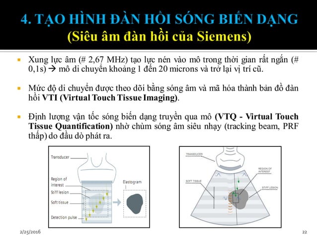 Tổng quan siêu âm đàn hồi và ứng dụng trong cơ xương khớp, Bs Liêm | PDF