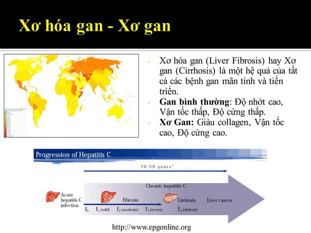 Tổng quan siêu âm đàn hồi và ứng dụng trong cơ xương khớp, Bs Liêm | PDF