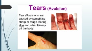 BOY SCOUTS OF THE PHILIPINES - FIRST AID.pptx