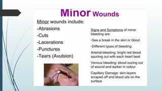 BOY SCOUTS OF THE PHILIPINES - FIRST AID.pptx