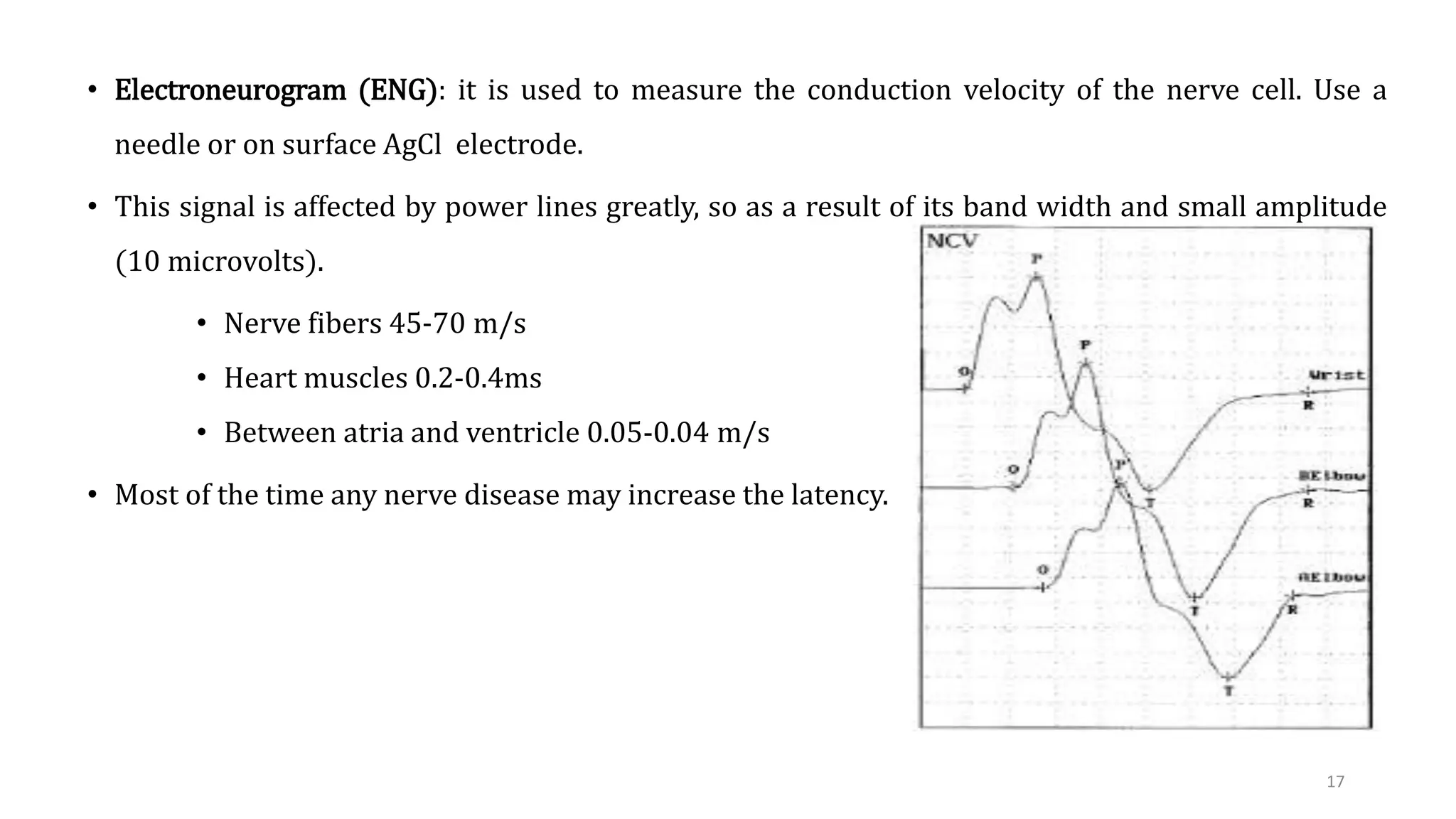 biomedical signals processing fundamentals | PPTX | Heart and Cardiovascular Diseases | Diseases ...