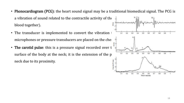 biomedical signals processing fundamentals | PPTX | Heart and Cardiovascular Diseases | Diseases ...