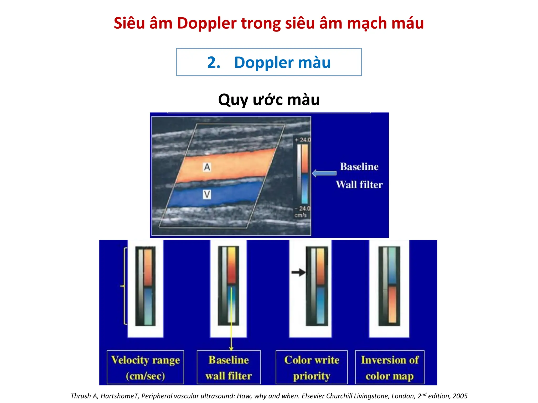 Bs Phuong - Nguyen ly co ban sieu am Doppler mach mau.pdf