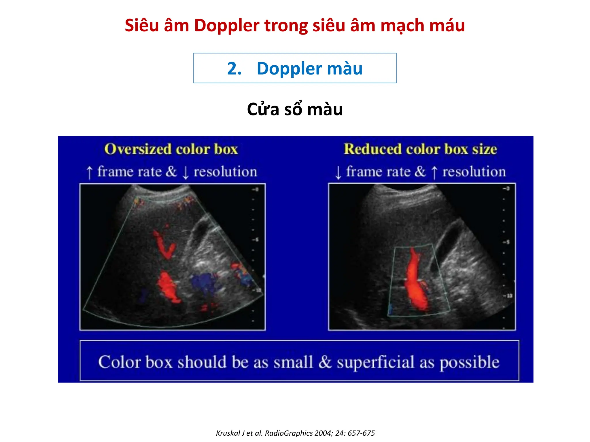 Bs Phuong - Nguyen ly co ban sieu am Doppler mach mau.pdf