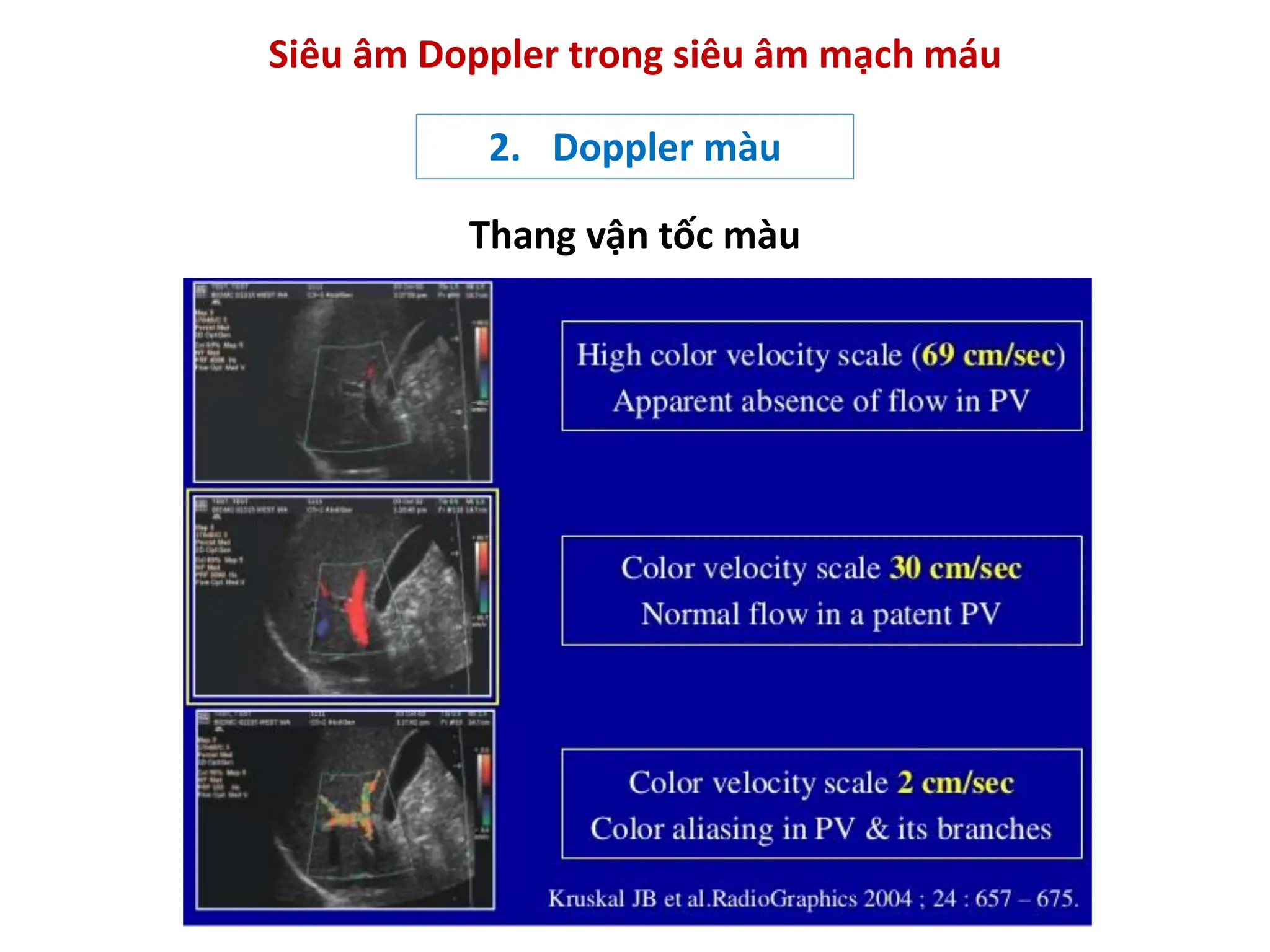 Bs Phuong - Nguyen ly co ban sieu am Doppler mach mau.pdf