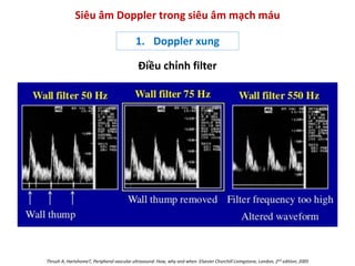 Bs Phuong - Nguyen ly co ban sieu am Doppler mach mau.pdf
