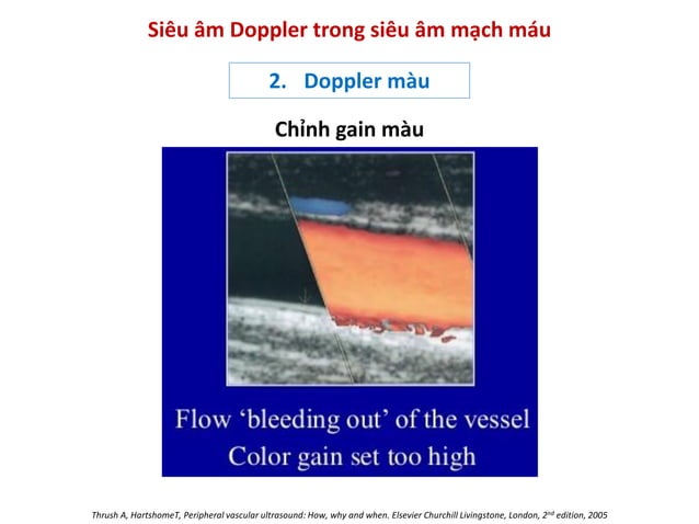 Bs Phuong - Nguyen ly co ban sieu am Doppler mach mau.pdf
