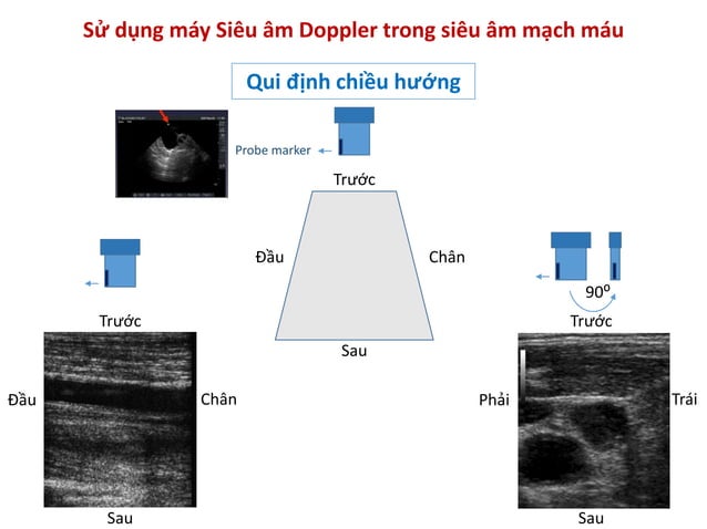 Bs Phuong - Nguyen ly co ban sieu am Doppler mach mau.pdf