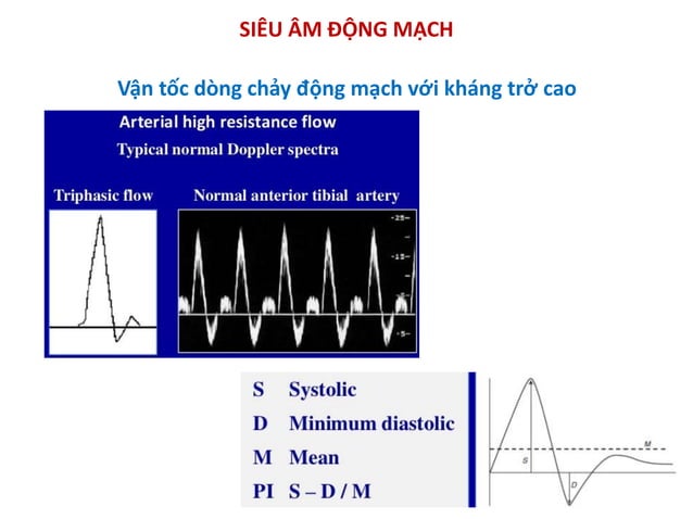 Bs Phuong - Nguyen ly co ban sieu am Doppler mach mau.pdf