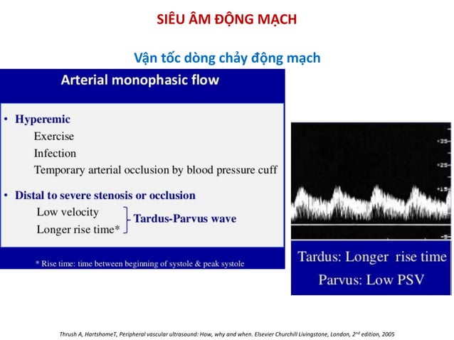 Bs Phuong - Nguyen ly co ban sieu am Doppler mach mau.pdf