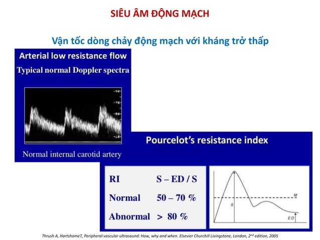 Bs Phuong - Nguyen ly co ban sieu am Doppler mach mau.pdf