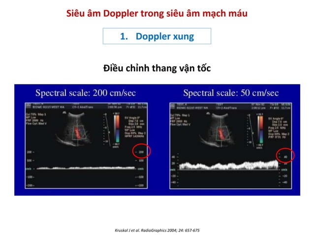 Bs Phuong - Nguyen ly co ban sieu am Doppler mach mau.pdf