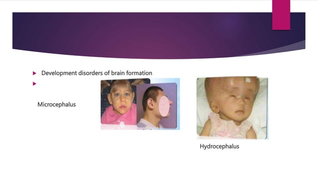 BS PRESENTATION.pptx all concept about disabilities | PPT