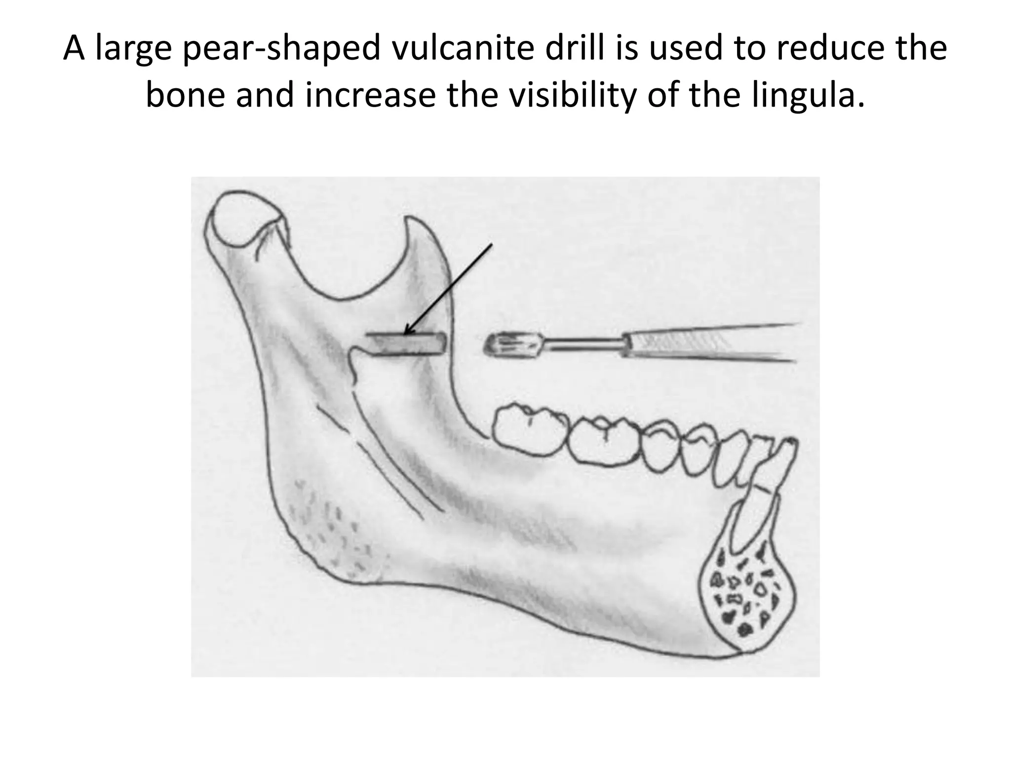 Bsso | PPTX | Dental Health | Diseases and Conditions