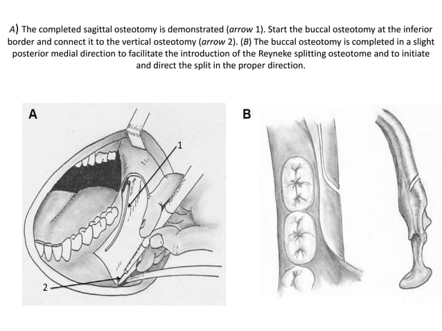 Bsso | PPTX | Dental Health | Diseases and Conditions