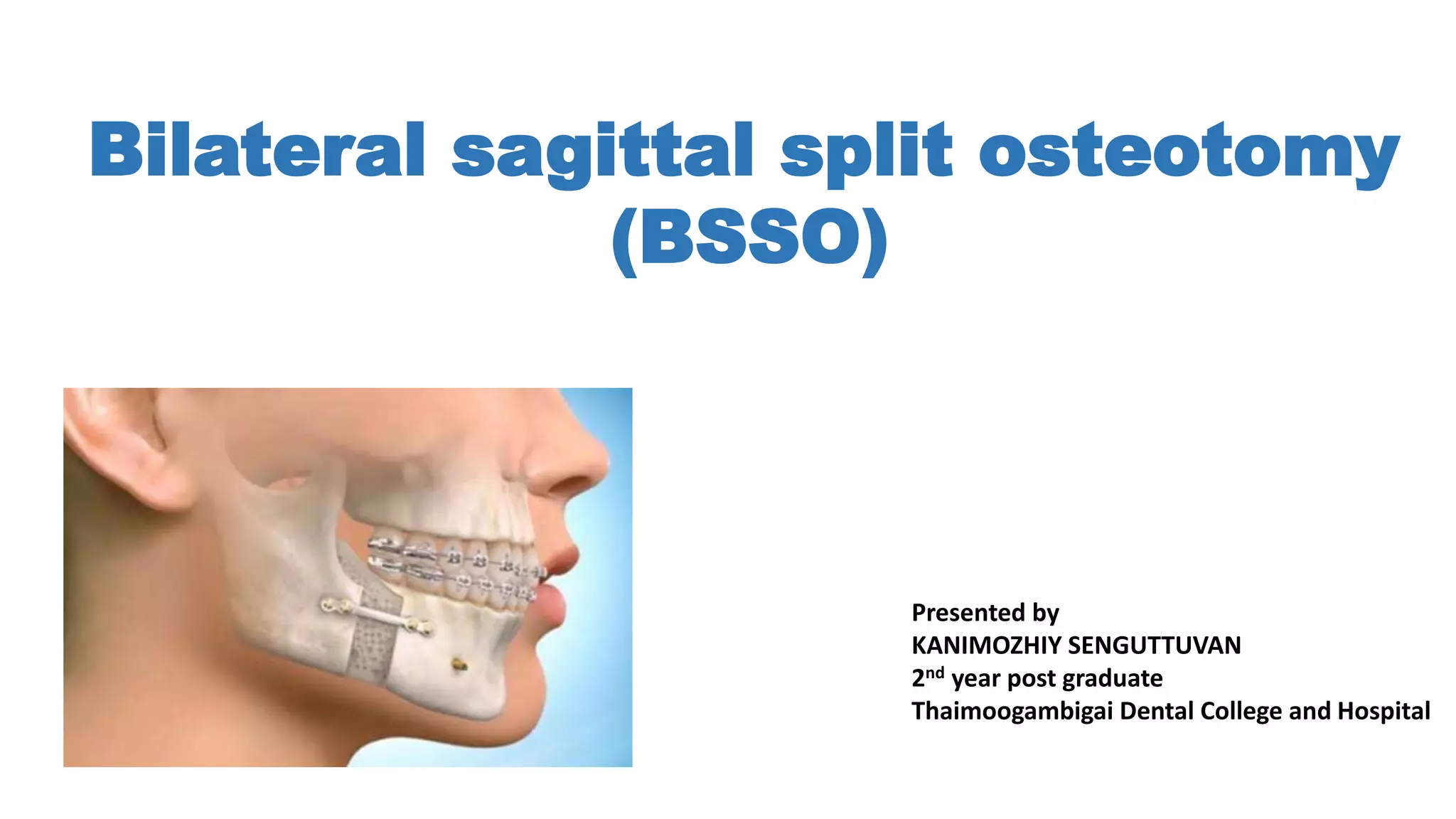 Bsso | PPTX