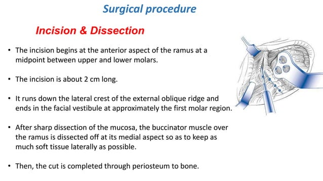Bsso | PPTX | Death, Injury, or Military Conflict | Sensitive Topics