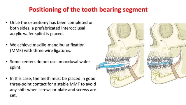 Bsso | PPTX | Death, Injury, or Military Conflict | Sensitive Topics