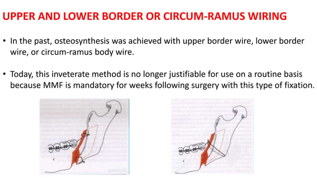 Bsso | PPTX | Death, Injury, or Military Conflict | Sensitive Topics