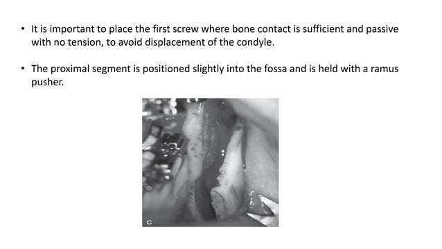 Bsso | PPTX | Death, Injury, or Military Conflict | Sensitive Topics