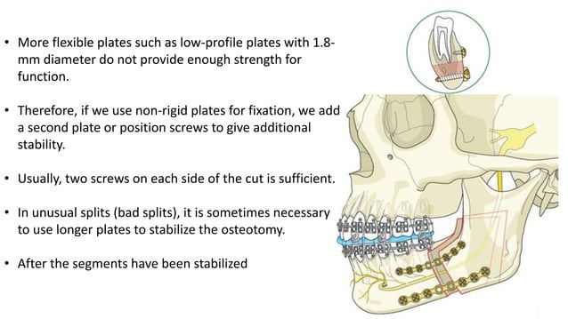 Bsso | PPTX | Death, Injury, or Military Conflict | Sensitive Topics