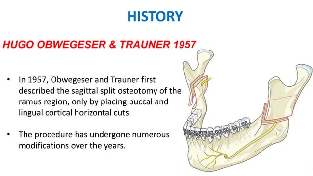 Bsso | PPTX | Death, Injury, or Military Conflict | Sensitive Topics